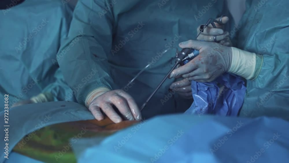 Doctor doing operation. Professional smart intelligent surgeons ...