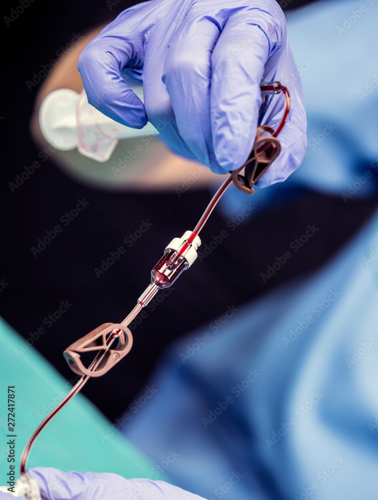 Nurse prepares Venous catheters of Long Duration in a hospital ...