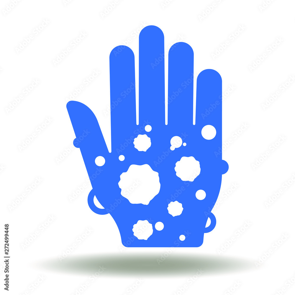 Vecteur Stock Hand blebs and blisters icon vector. Eczema or ...