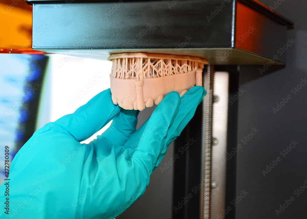 In the 3D printing process of plastic, a tooth correction splint model ...