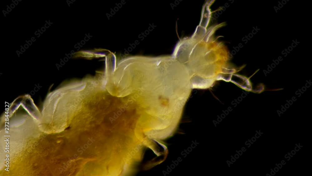 insect larva Worm-shaped, under a microscope, has three pairs of short ...