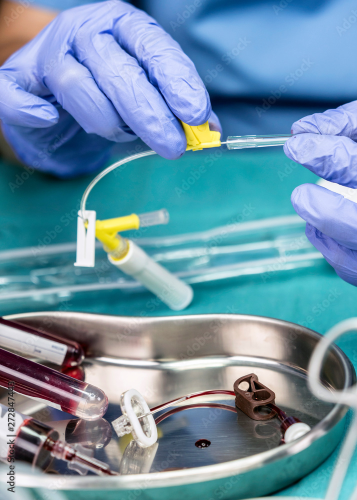 Nurse prepares Venous catheters of Long Duration in a hospital ...