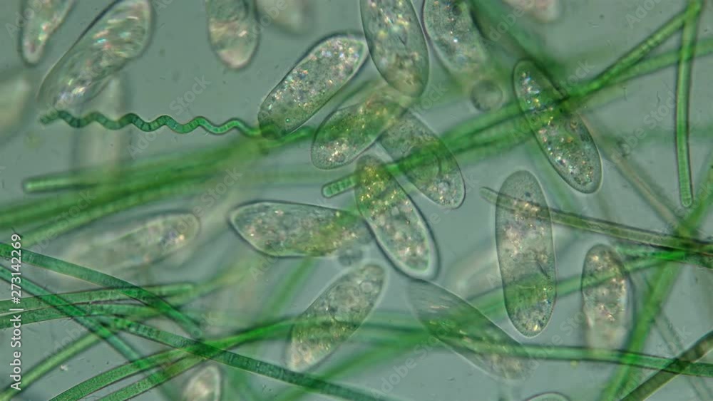 infusorium Paramcium under a microscope, movement of a colony of ...