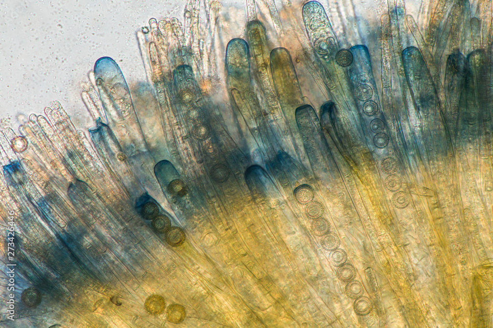 microscopic view of Plicariella cup fungus showing asci, spores and ...