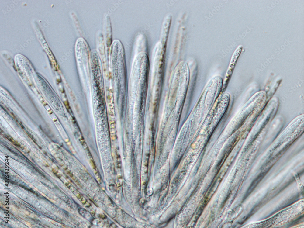 microscopic view of Lachnellula ellisiana cup fungus showing spores ...