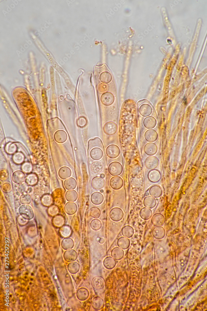 microscopic view of spores, asci and paraphyses of Caloscypha fulgens ...