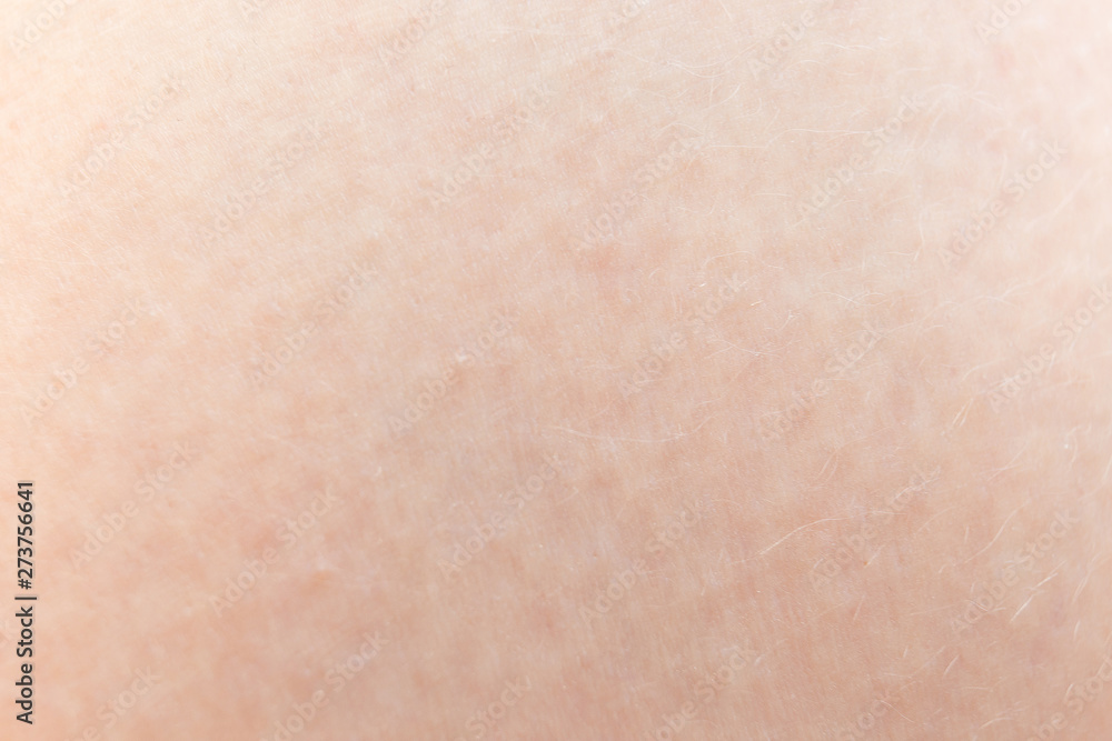 Macro of human skin. Human skin texture Stock Photo | Adobe Stock