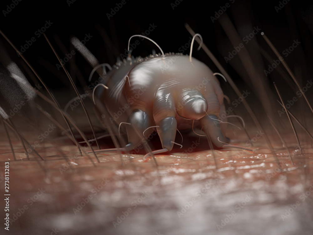 3d rendered medically accurate illustration of a scabies mite on human ...