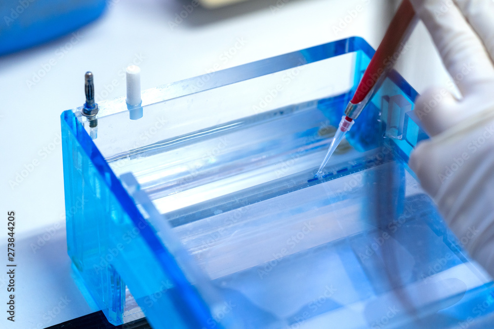 Molecular technique gel electrophoresis for DNA sample method decrypt ...