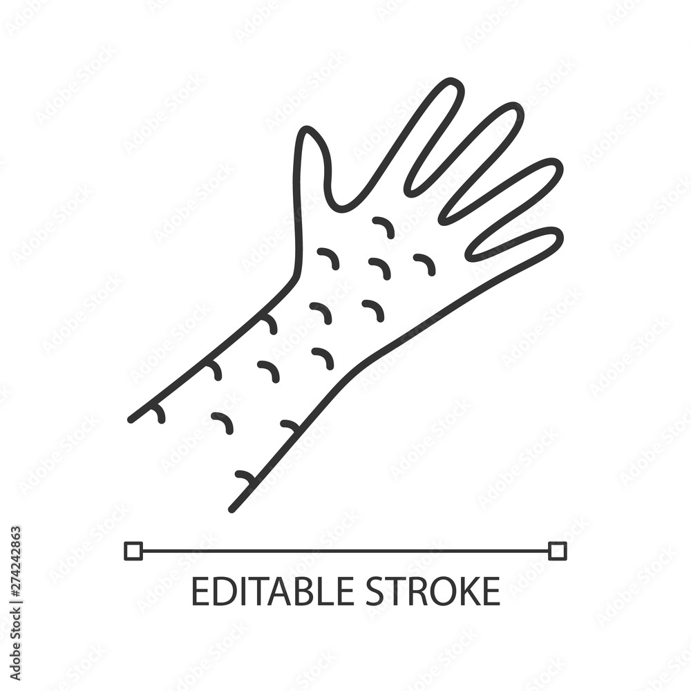 Skin rash, contact dermatitis linear icon Stock Vector | Adobe Stock