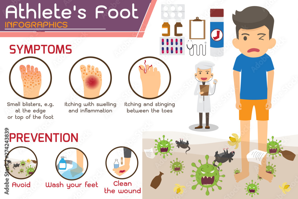Athlete’s foot or Hong kong foot Disease Infographics. wounds on foot ...