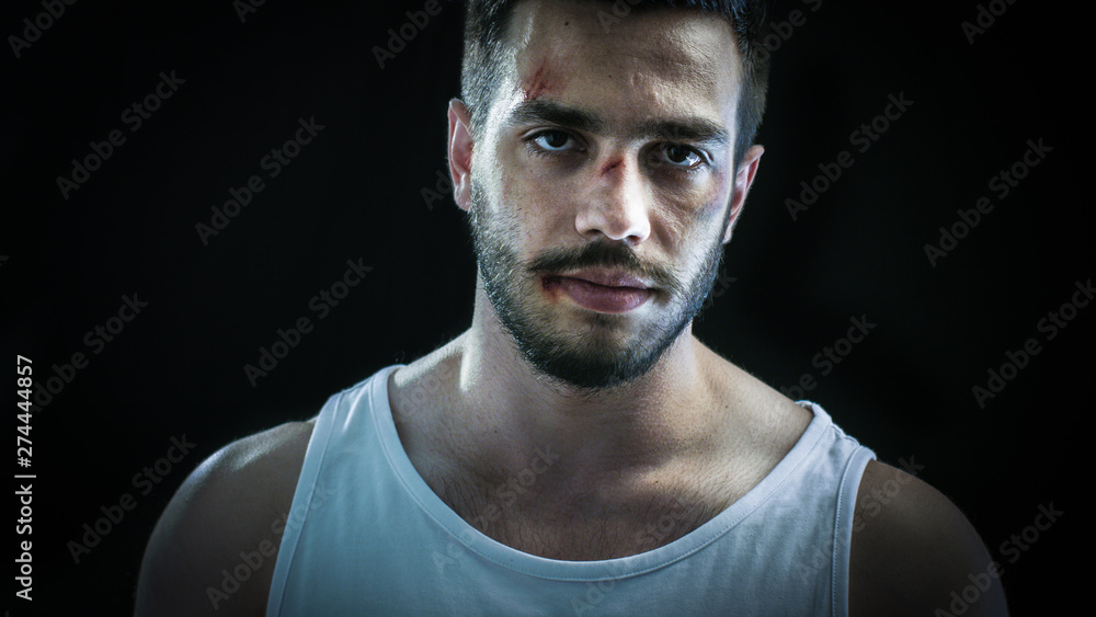 Aggressive Man with a Bruised Face Wearing Singlet Standing and ...