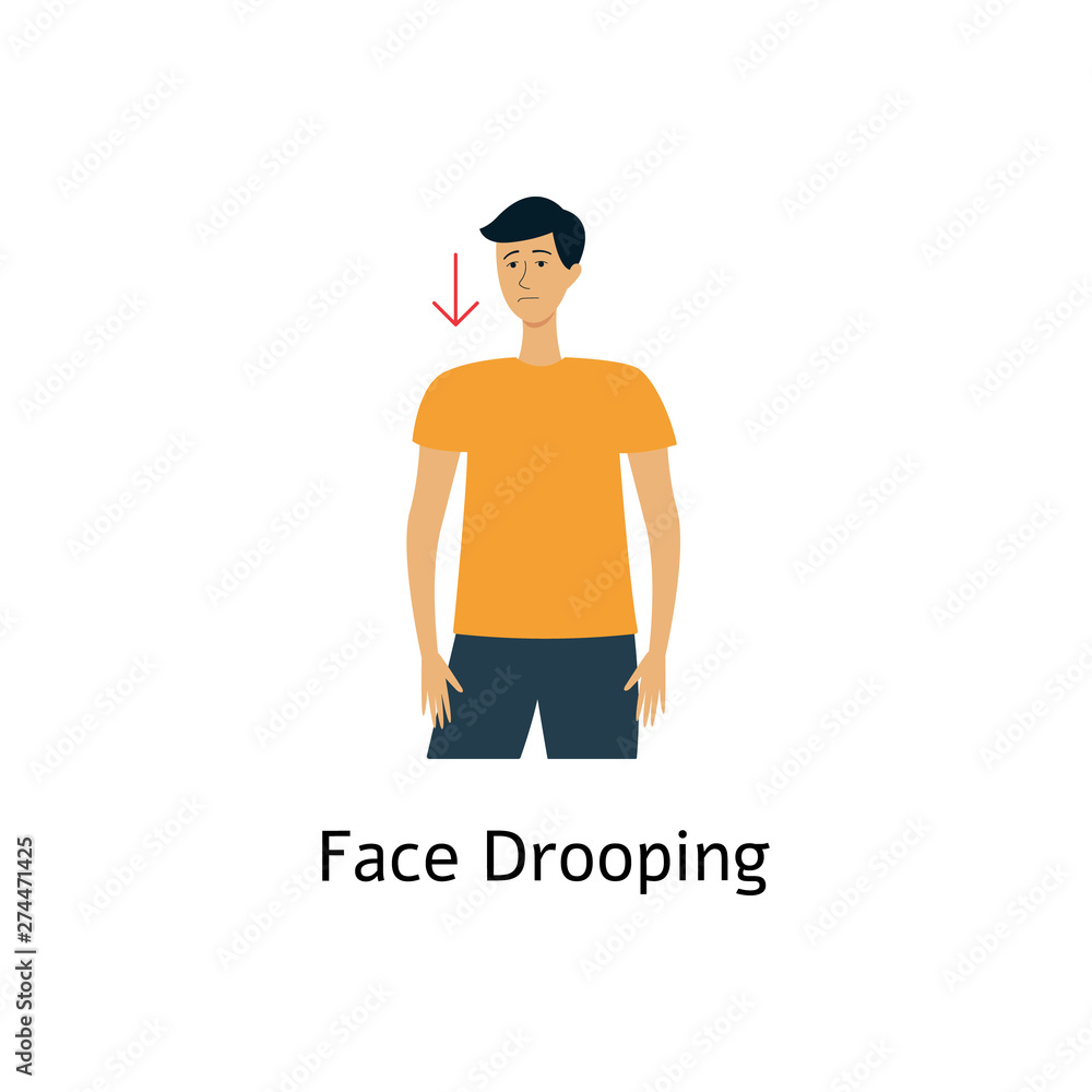 Face drooping - first warning sign of stroke and heart attack. เวกเตอร์ ...