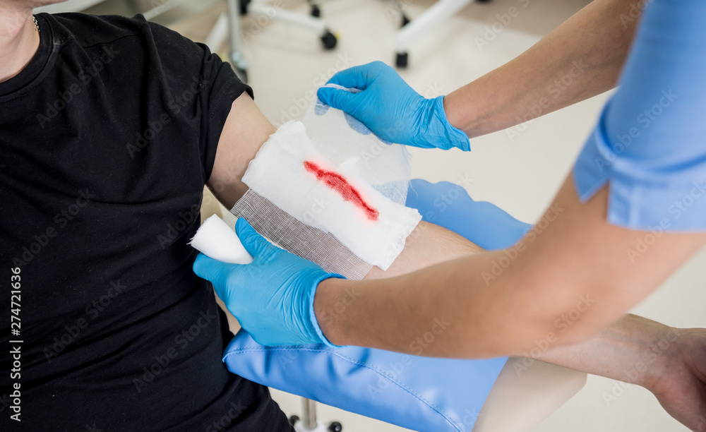 Nurse dressing wound for patient's hand with deep skin cutting. Stock ...