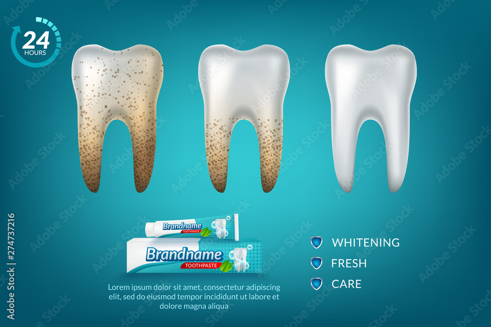 Whitening toothpaste ad poster. Vector realistic toothpaste packaging ...