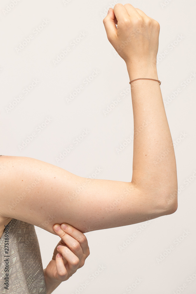 A close up view of a Caucasian woman squeezing her arm showing saggy ...
