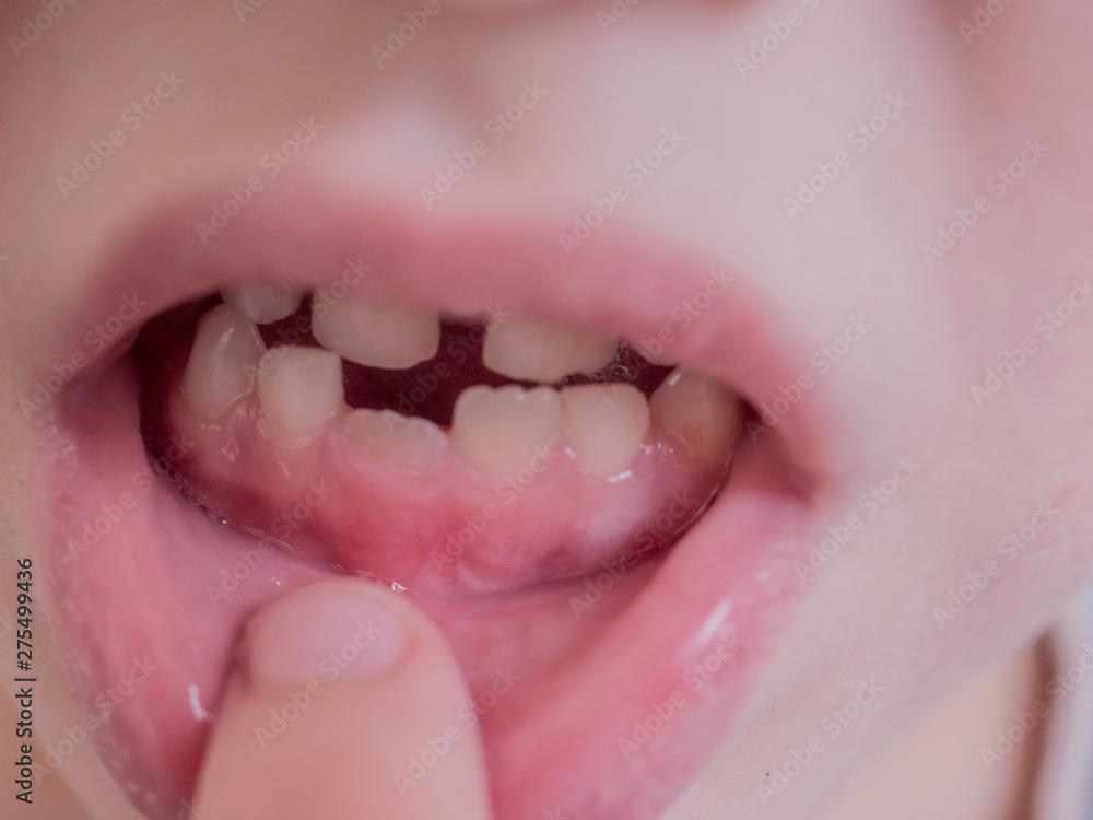 Cute Baby Lips Pictures | Lipstutorial.org