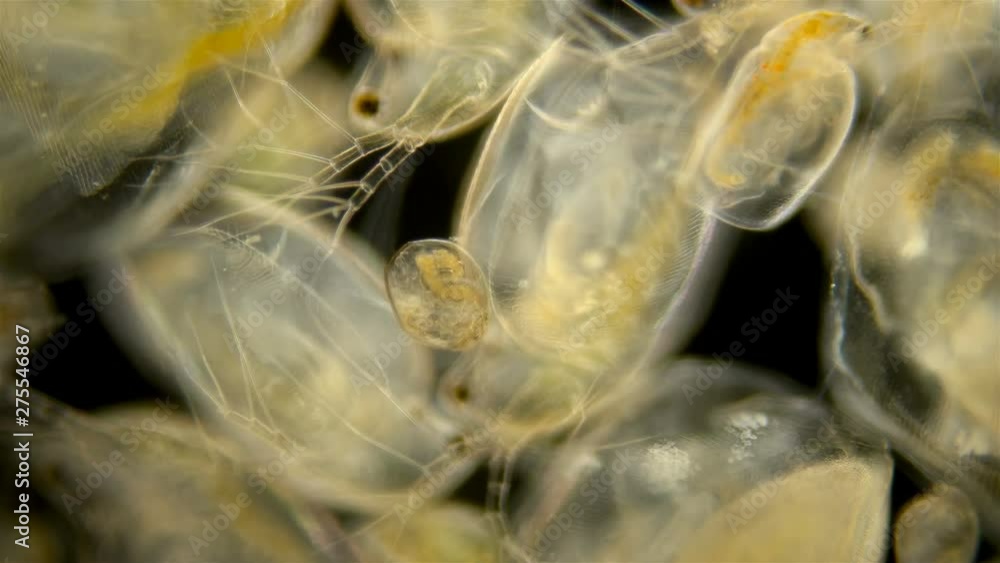 Zooplankton under the microscope. A colony of different plankton ...