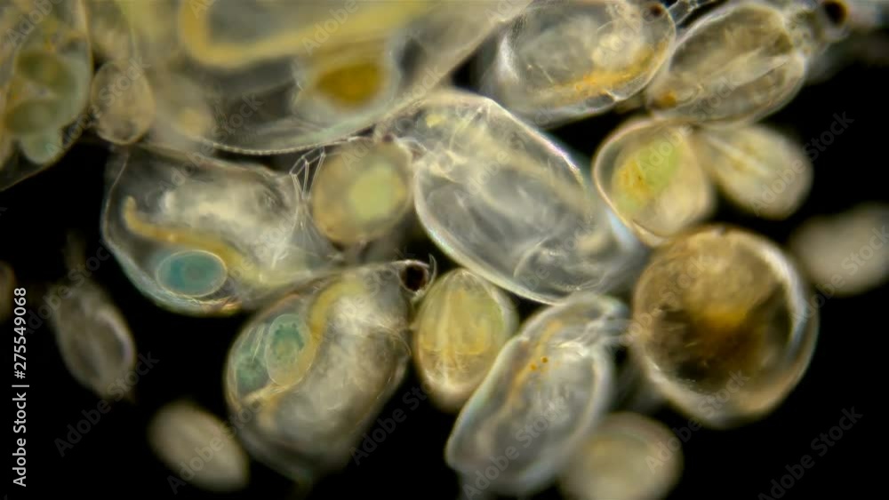 Zooplankton under the microscope. A colony of different plankton ...