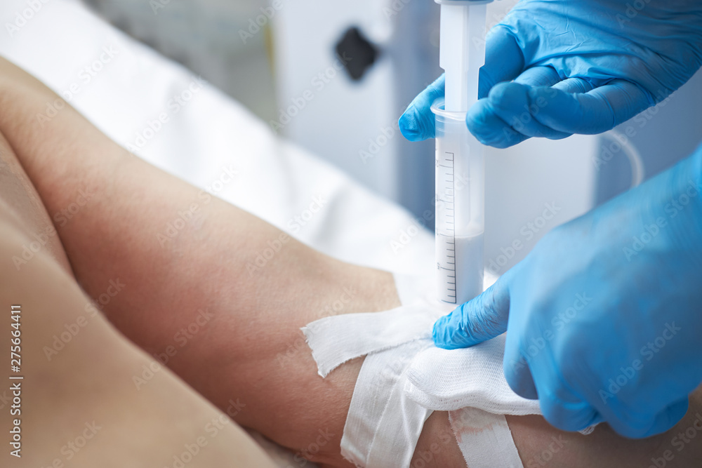nurse's hands in blue latex gloves perfoming injection of propofol to ...