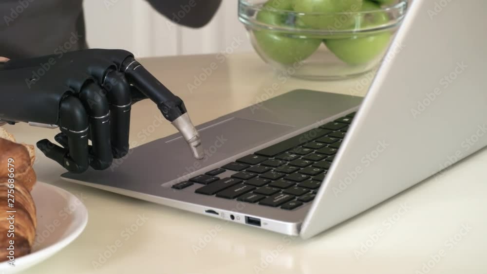 Close-up hand shot of amputee with myoelectric prosthetic forearm ...