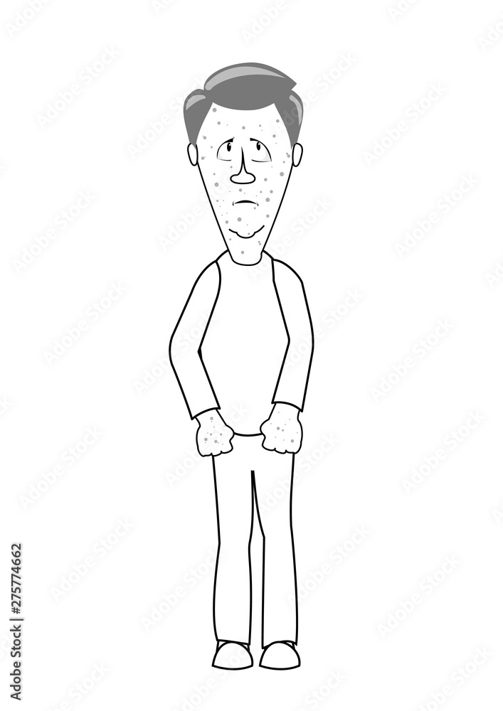 A person with skin rashes,allergies,virus,dermatitis.Vector image ...