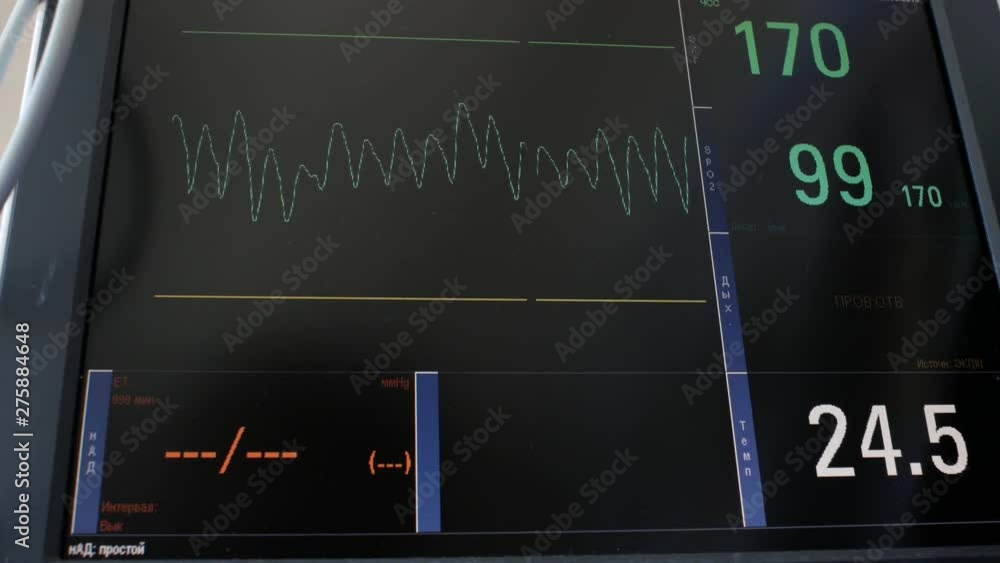 display of the electrocardiograph, graphs of the electrical activity of ...