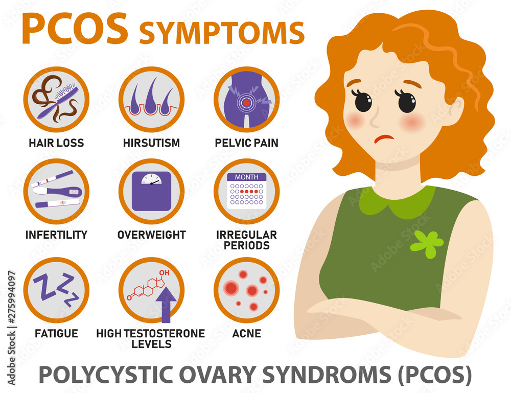 Symptoms of PCOS infographics. Detailed vector infographics. Stock ...