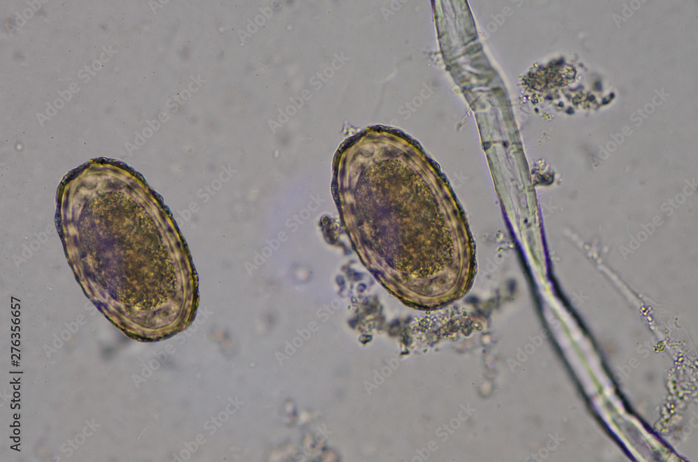 Kids Microscope Slides Carolina Microscope Slide - Ascaris Lumbricoides ...