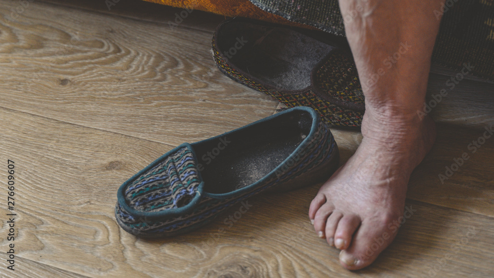 old foot, damaged toes and wrinkled legs with veins of old woman. skin ...