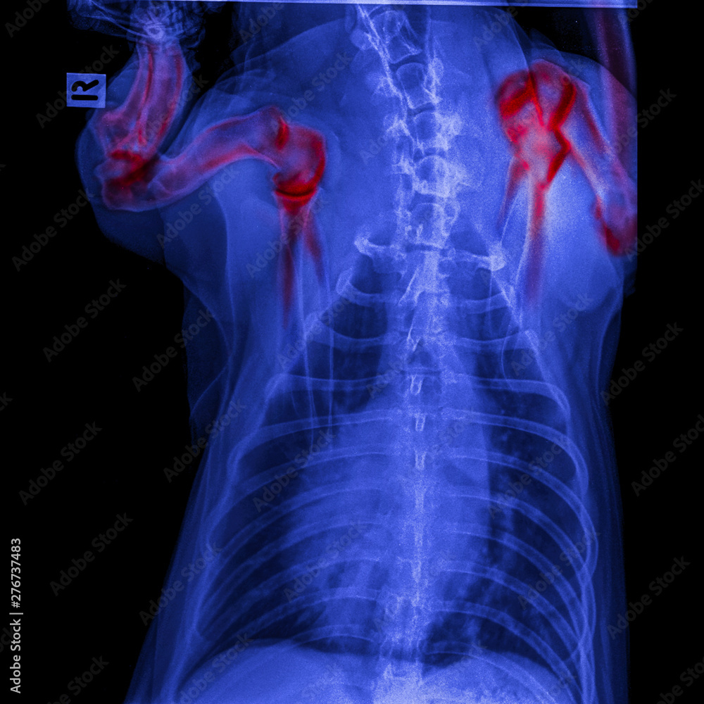 X-ray of dog posterior view closed up thorax and chest red highlight ...