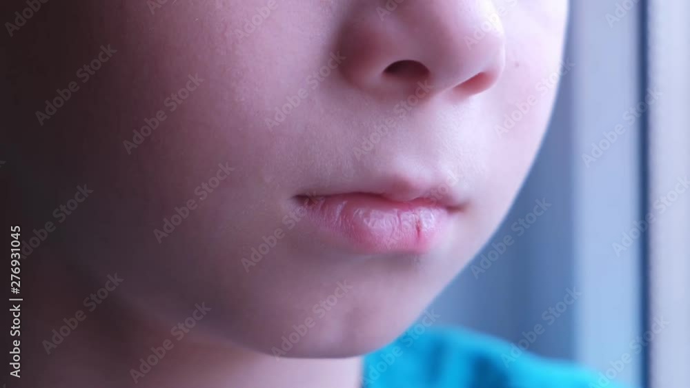 Little cut on boy's lip. Child boy with cracked dry lip, mouth closeup ...