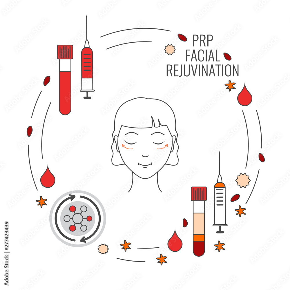 PRP facial injection for facelift and rejuvenation treatment ...