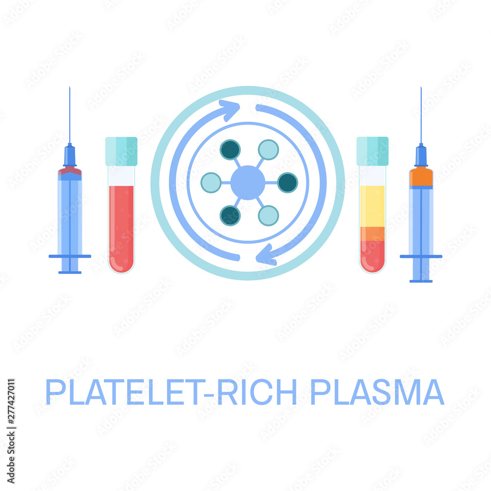 PRP procedure process vector infographics with test tubes and syringes ...