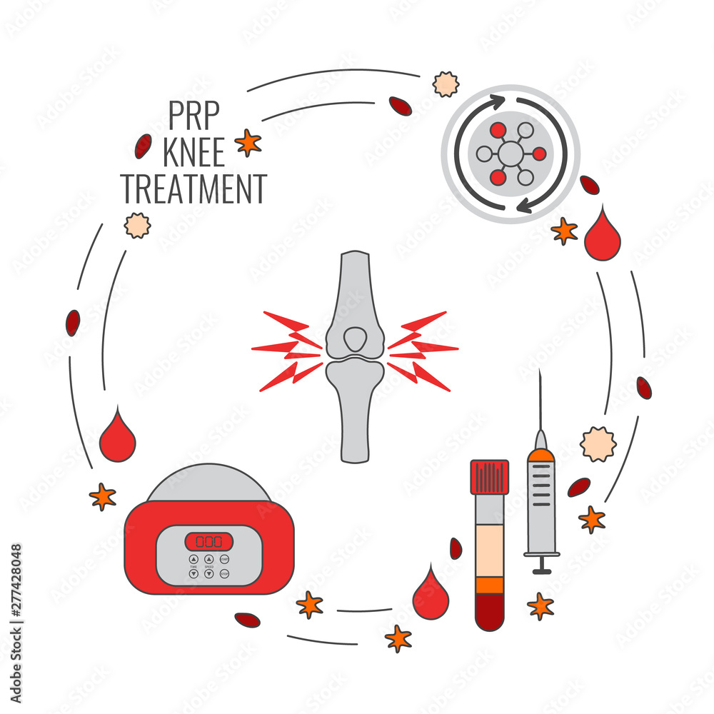 Vetor de PRP injection for knee arthritis and osteoarthritis treatment. Separation of platelets ...