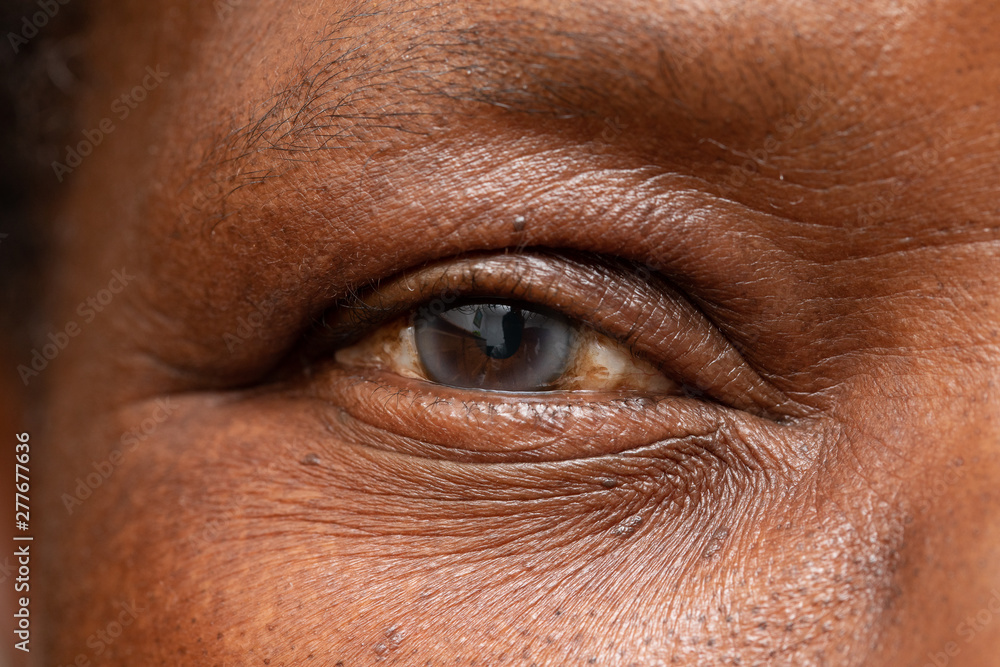 African American Eye