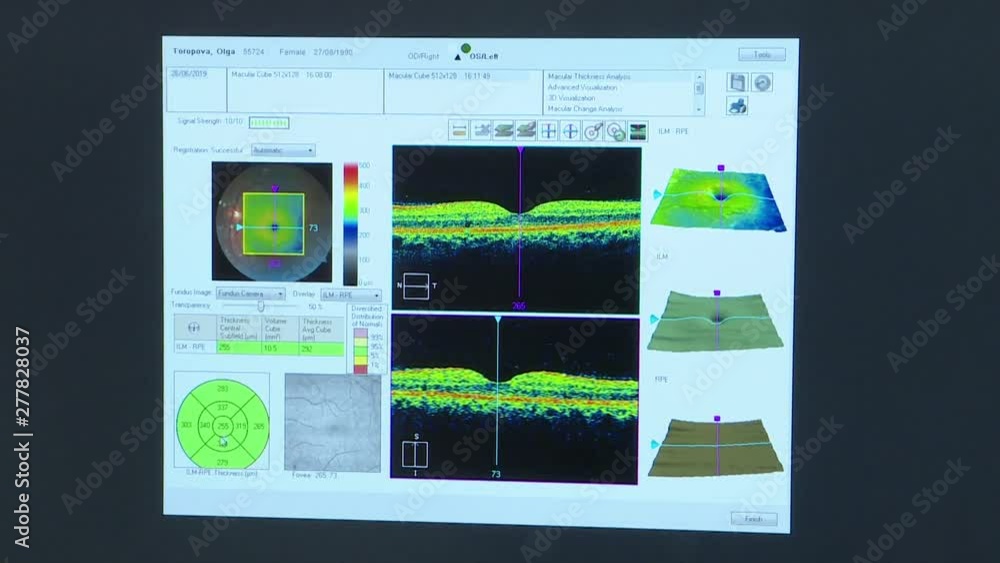 Vídeo do Stock: Ophthalmological examination on a computer , eye health ...