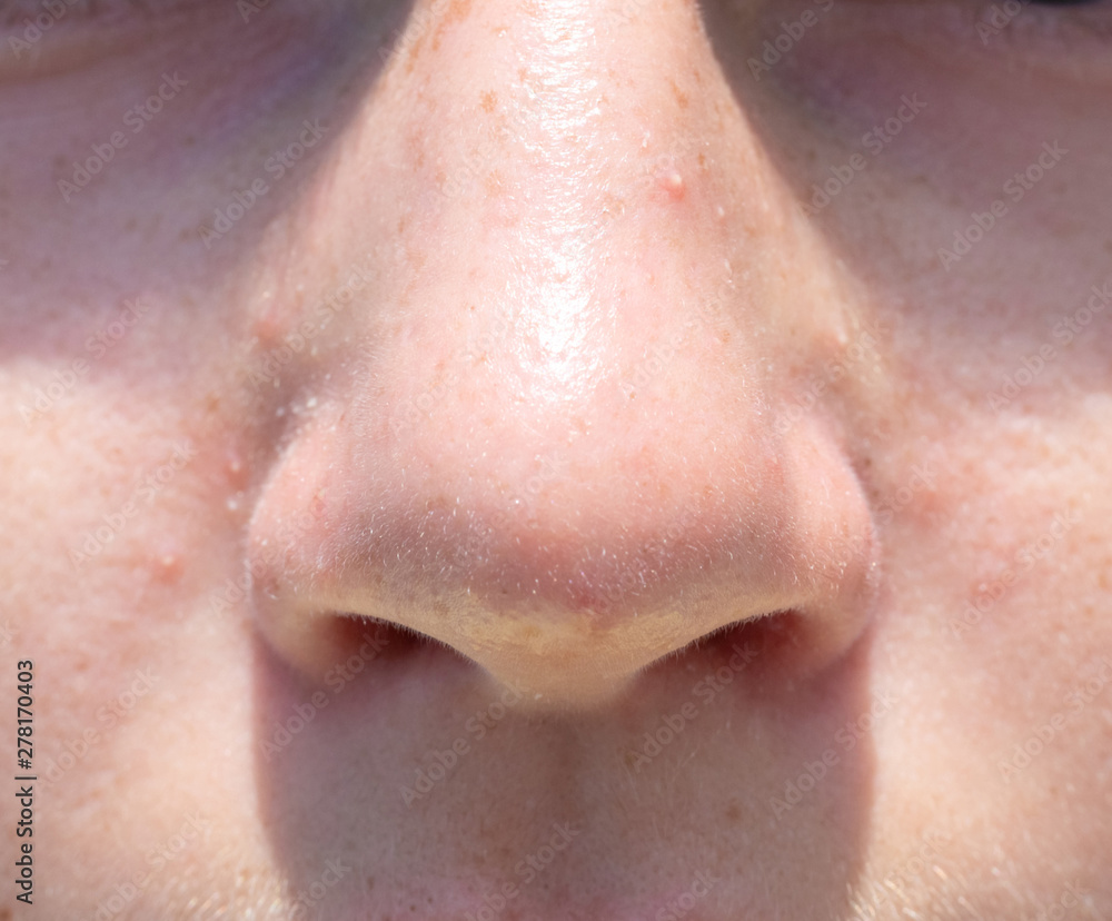 Female Nose Front View