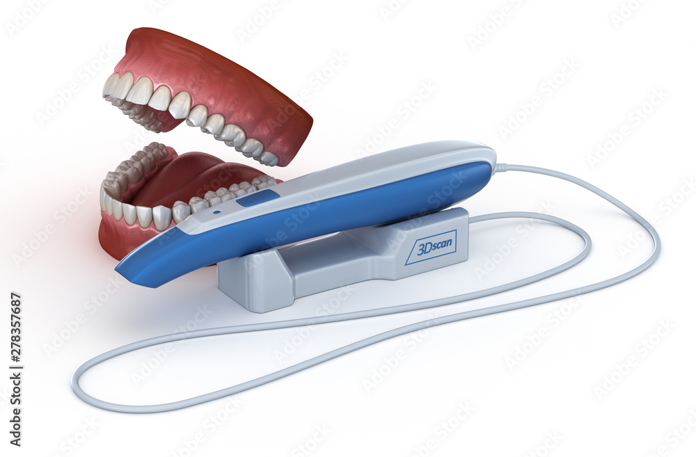 Intraoral Teeth 3D scanner. My own design. 3D illustration concept ...