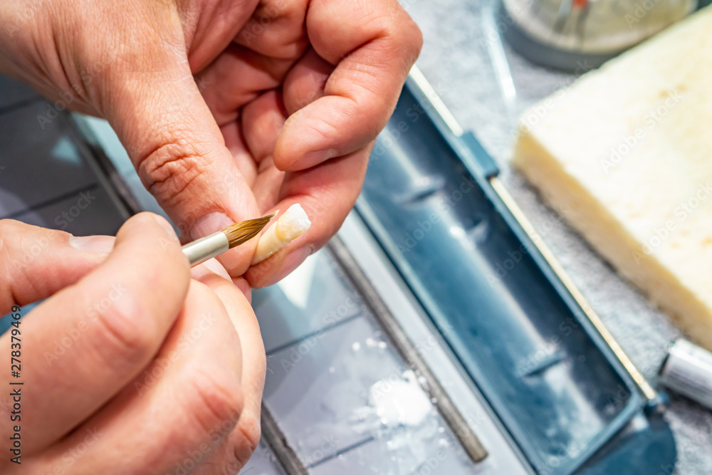 Production of dental veneers. Dental technician at work. Dental ...