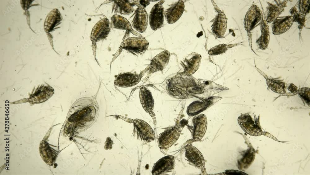 Zooplankton under the microscope. A colony of different plankton ...