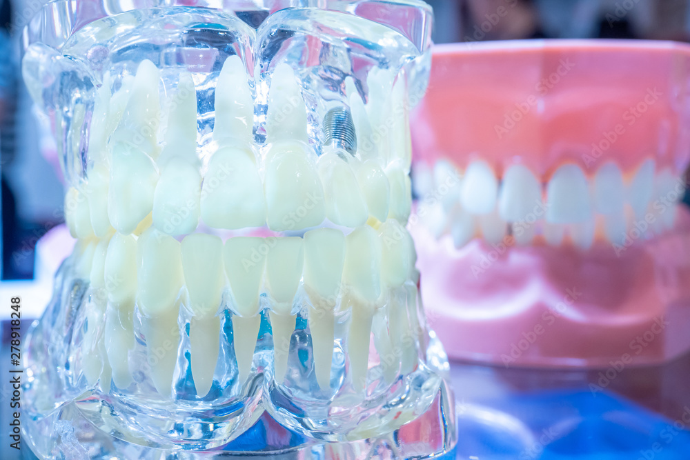 Artificial teeth models. The models of the jaw. Jaw layouts. Dental ...