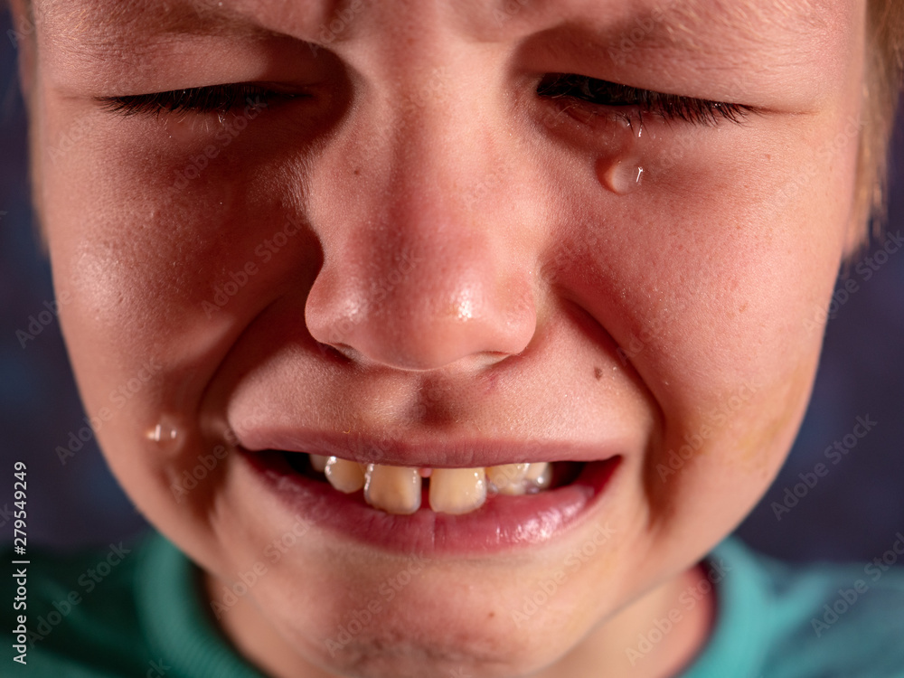Face of crying boy close up. Eyes, eyelashes, eyebrows, lips, teeth and ...