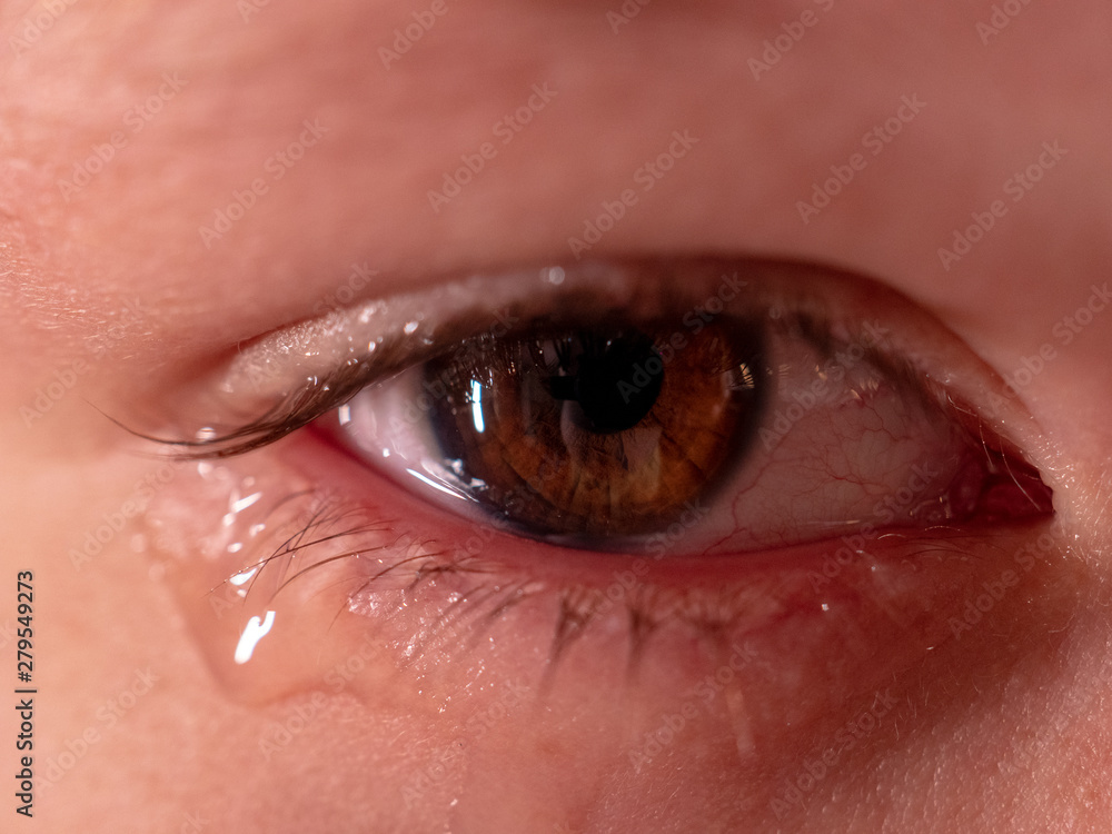 Face of crying boy close up. Eyes, eyelashes, eyebrows, lips, teeth and ...