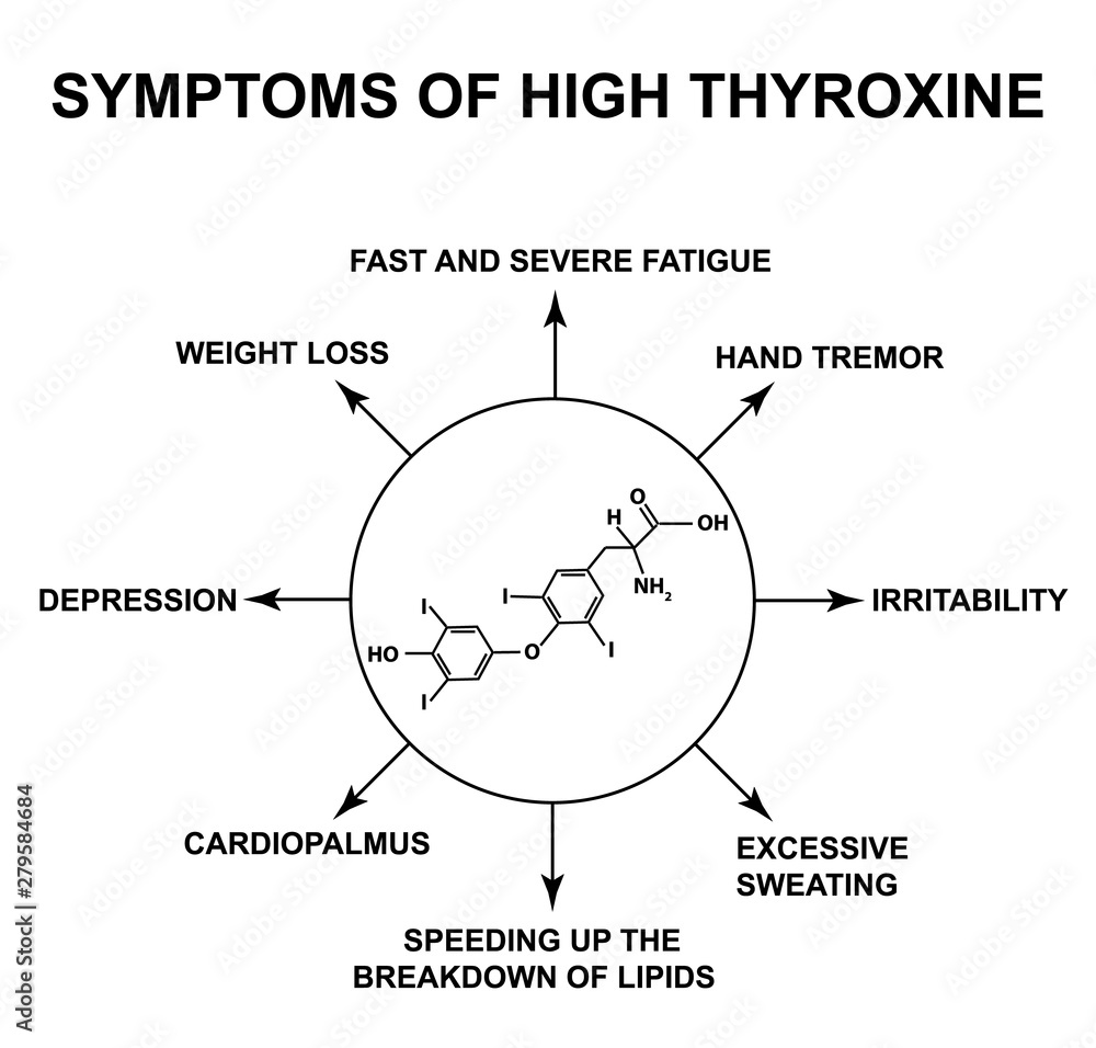 Symptoms of high thyroxine. Thyroxine thyroid hormone. Infographics ...