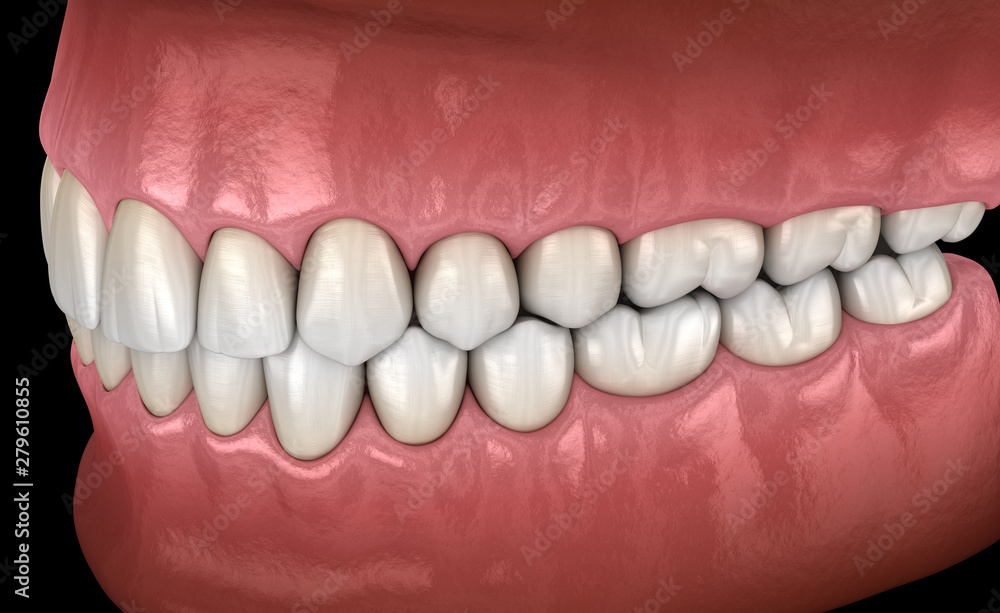 Healthy human teeth with normal occlusion, side view. Medically ...