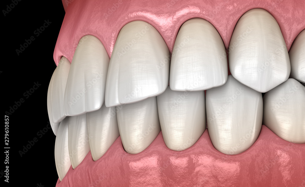 Healthy human teeth with normal occlusion, side view. Medically ...