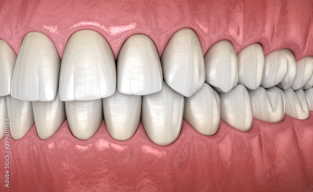 Healthy human teeth with normal occlusion, side view. Medically ...