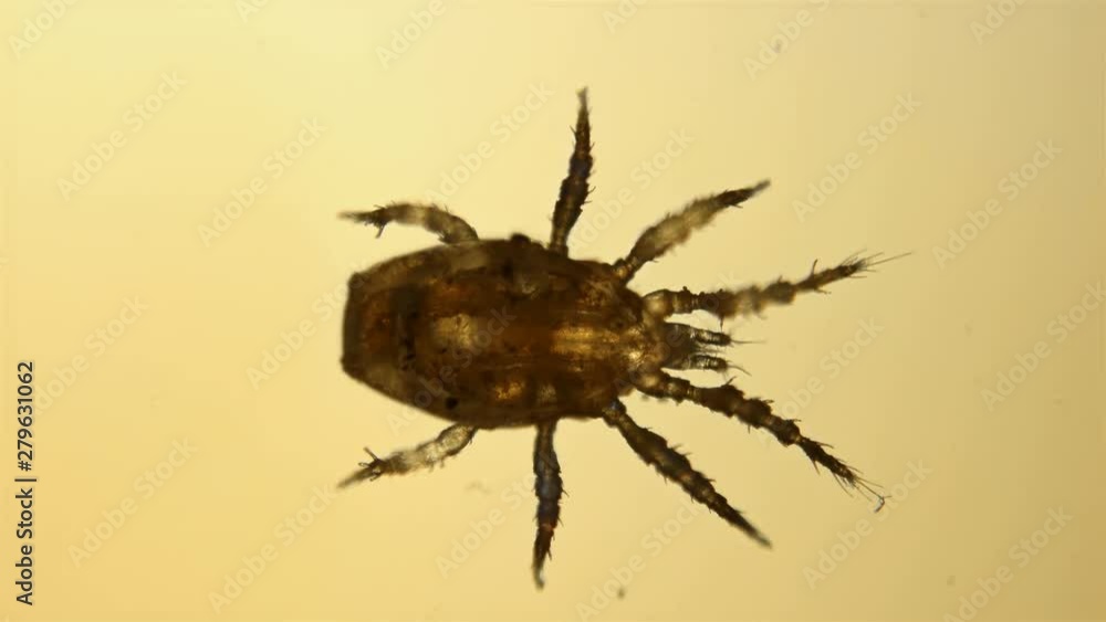 Acari mite under the microscope, Mesostigmata, possibly Trachytidae ...