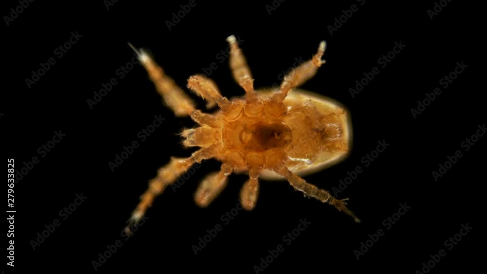 Acari mite under the microscope, Mesostigmata, possibly Trachytidae ...